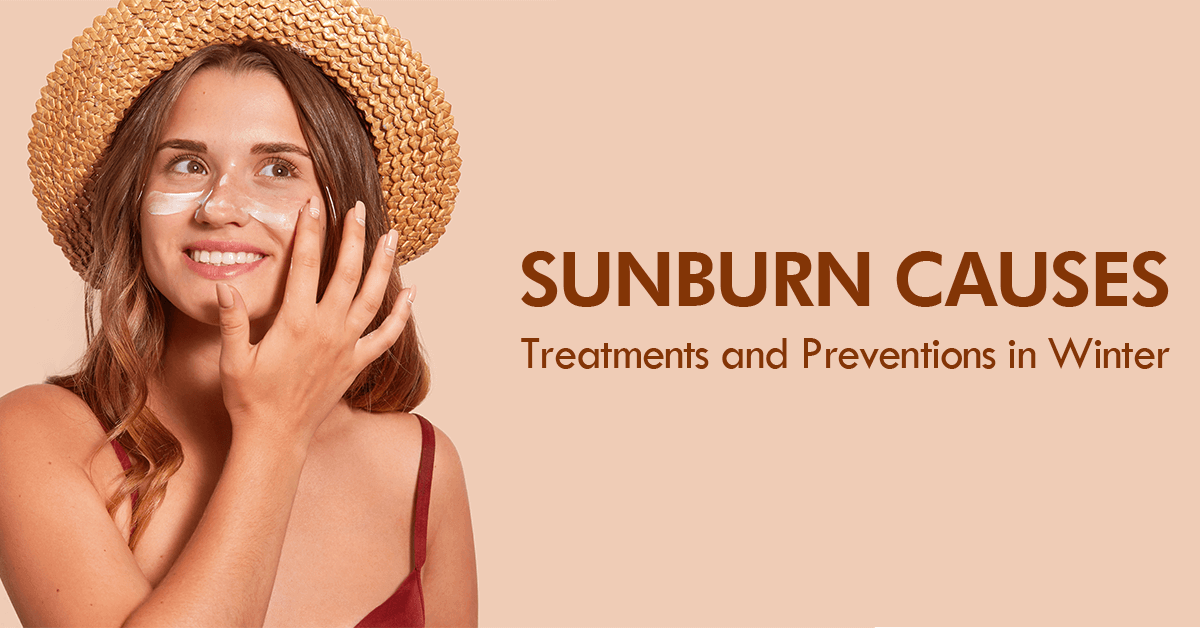 Sunburn Causes, Treatments and Preventions in Winter – Vince Care